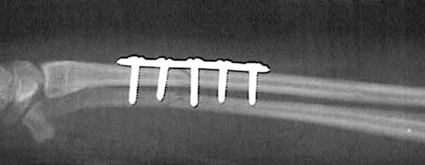 Common Medical Problems of Toy Breeds: Fractures • the Hi-lo