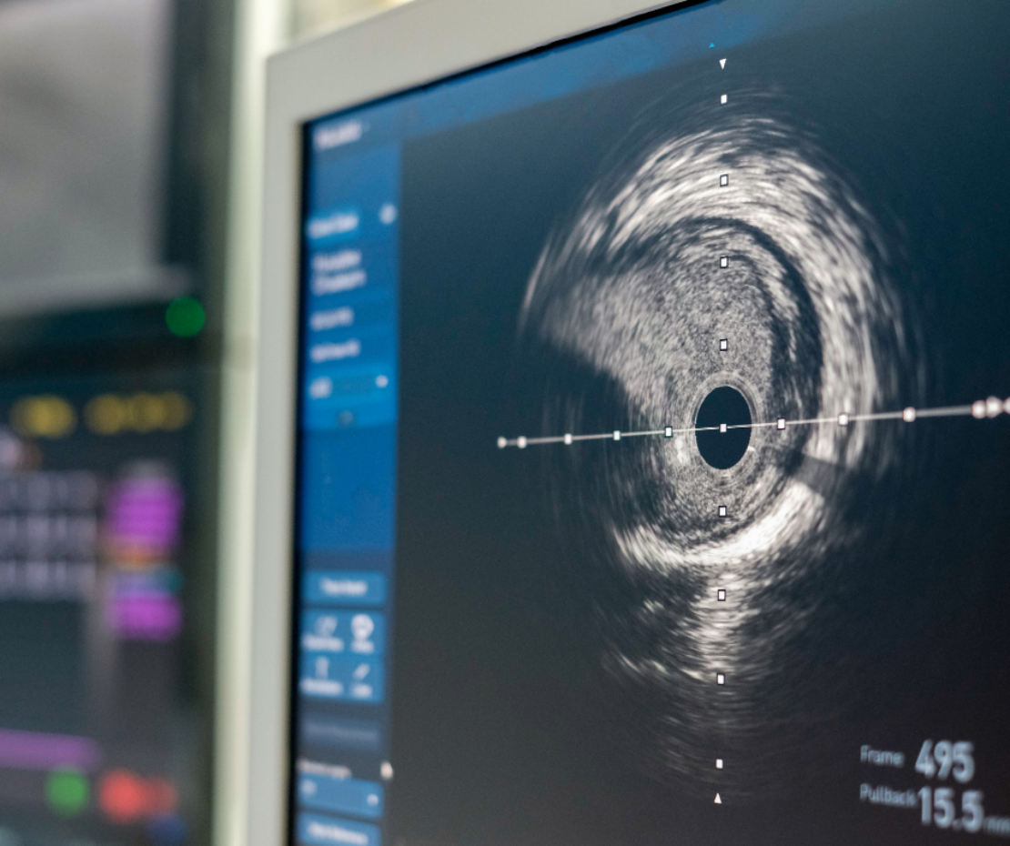 Advanced cardiac imaging offered at MemorialCare Long Beach Medical ...